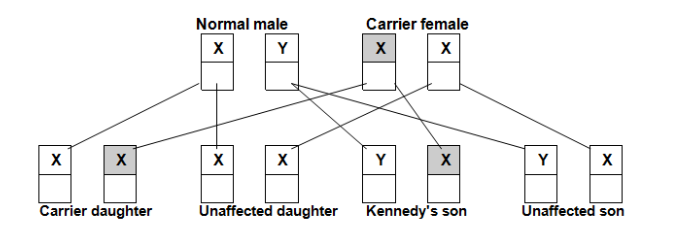 Kennedy's disease - MND Victoria